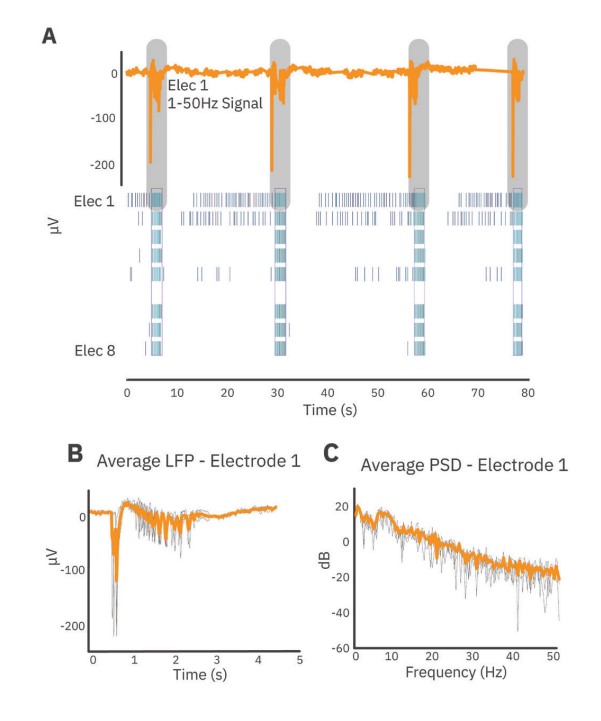 Characterization of functional neuronal activity in vitro with local field potential signals ...
